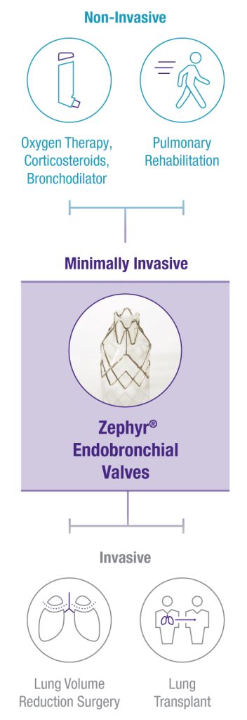 Zephyr Valve as a Treatment for Severe COPD/Emphysema - Zephyrvalves
